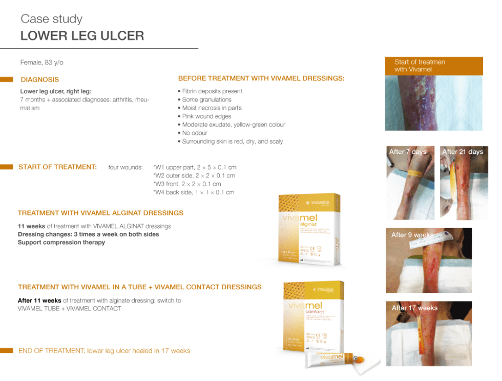 Wound case studies - Vivamel Medical Honey